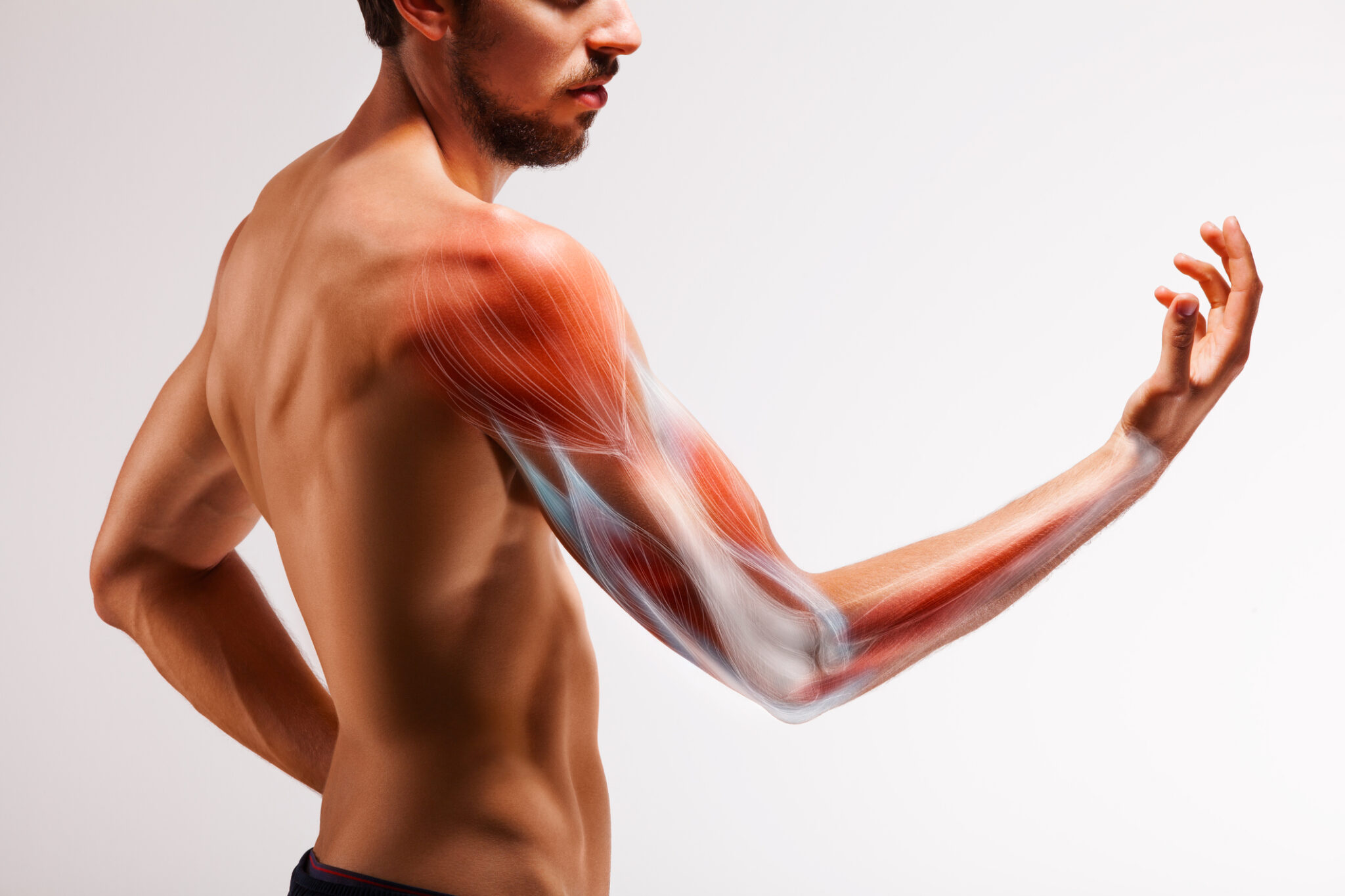Bicep Tendon Rupture Can I Still Workout With A Torn Bicep Tendon 